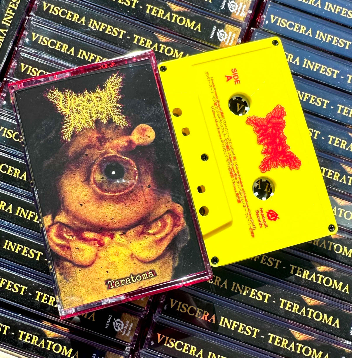 Viscera Infest "Teratoma" TAPE – Night Terrors Records